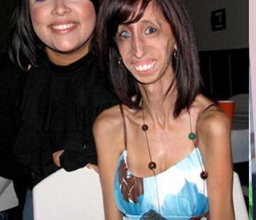Skinniest Woman Alive